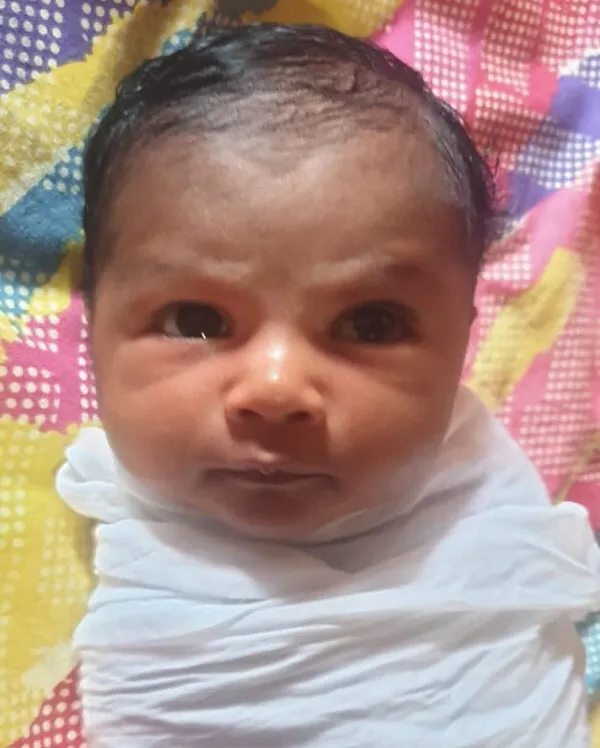 My baby has dark forehead – FirstCry Parenting