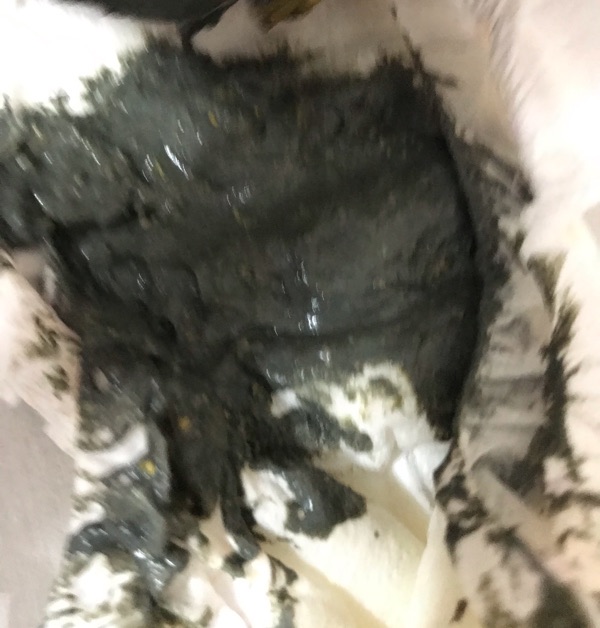 my baby is 4 months old..he is popping very irregular ly..plz advice ...