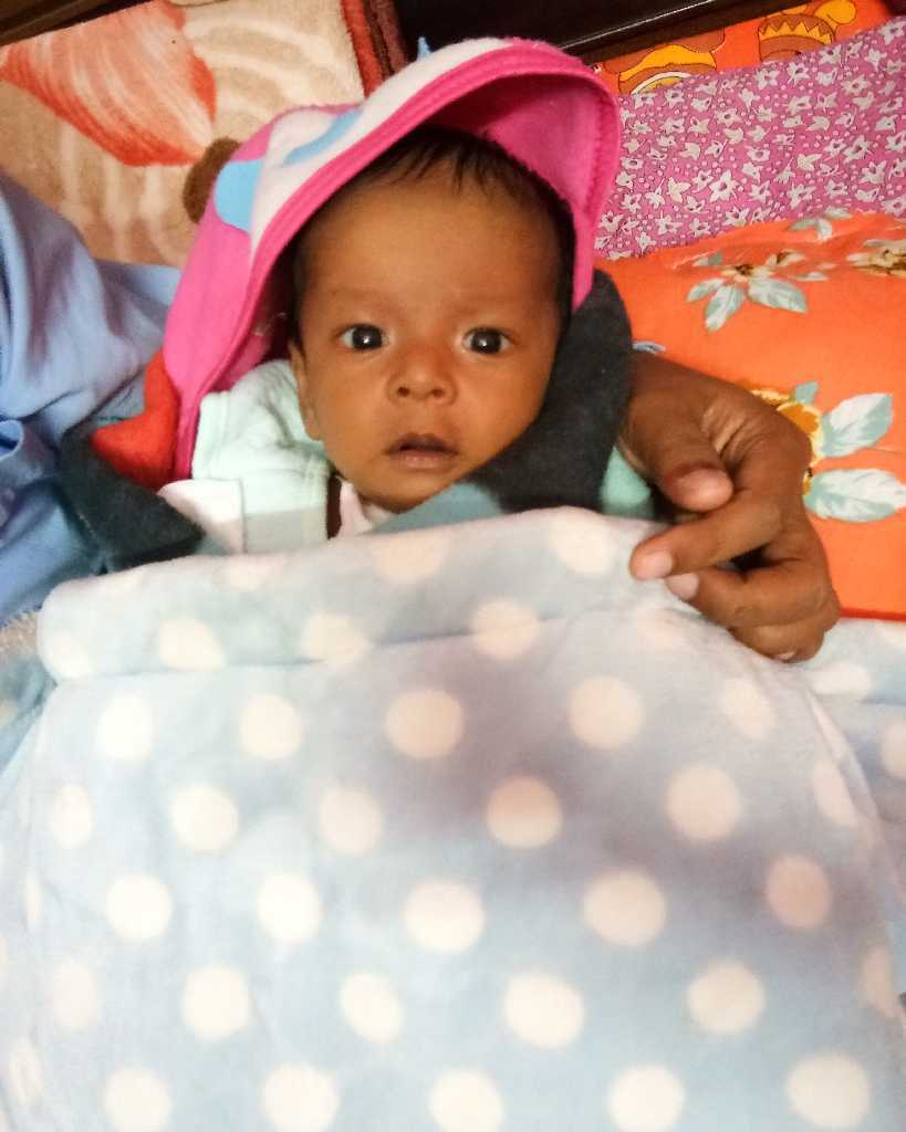 Common Symptoms of Mastitis